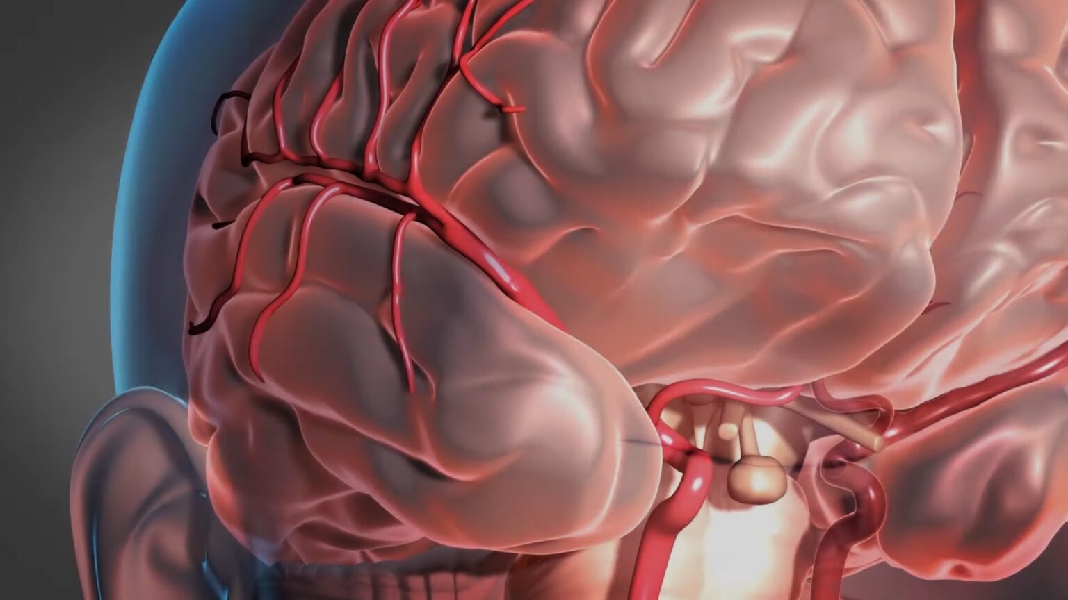 What’s the Difference Between a Stroke and a Brain Aneurysm?